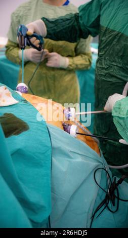 Obesity surgery. Weight loss surgery with laparoscopy technique Stock ...