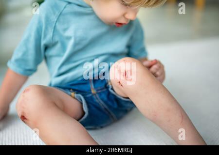 Helping a child perform first aid knee injury after she had an accident ...