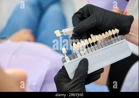 Vita scale. Bleaching teeth guide. Tooth color chart in dentist's hands ...