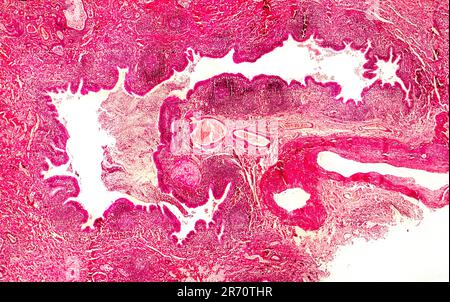 Lung. Light micrograph of a section through a rabbit lung. The lungs ...