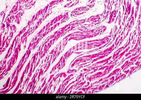 Brown atrophy of the heart, light micrograph, photo under microscope ...