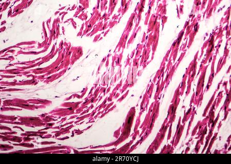 Brown atrophy of the heart, light micrograph, photo under microscope ...