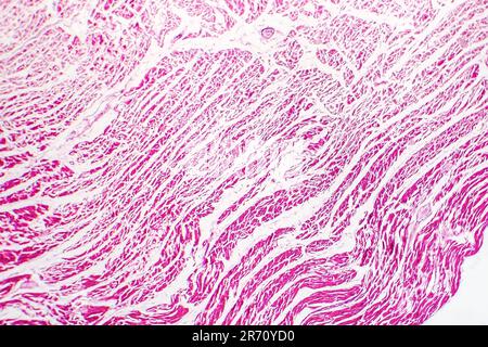 Brown atrophy of the heart, light micrograph, photo under microscope ...