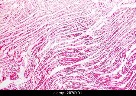 Brown atrophy of the heart, light micrograph, photo under microscope ...