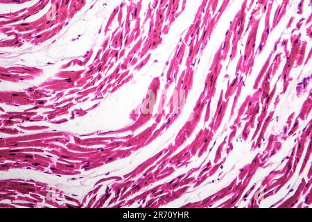 Brown atrophy of the heart, light micrograph, photo under microscope ...