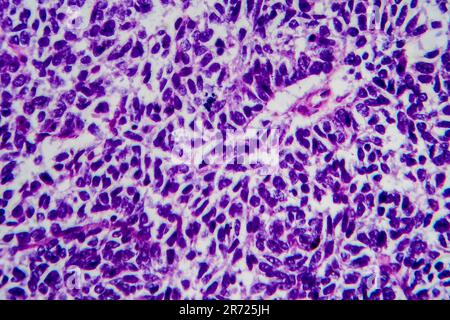 High magnification light micrograph of the renal cortex of a kidney ...