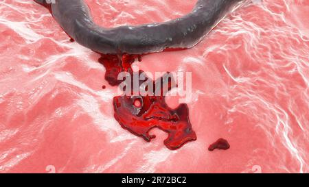 Hemorrhage, blood flowing from the damaged blood vessel, 3D ...