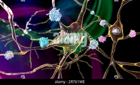 Neuronal inclusions in Huntington's disease, computer illustration ...