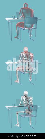 Working with laptop in a wrong position. Concept of back pain. Computer ...