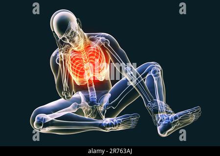 Chest pain. Conceptual computer artwork of chest pain, shown as red ...