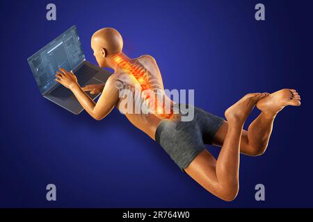 Working with laptop in a wrong position. Concept of back pain. Computer ...