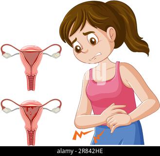 Infographic of stages of the menstrual cycle illustration Stock Vector Image & Art - Alamy