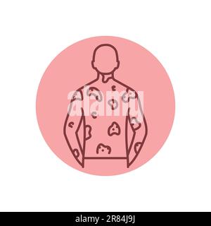 Pustular psoriasis black line icon. Autoimmune diseases. Pictogram for ...