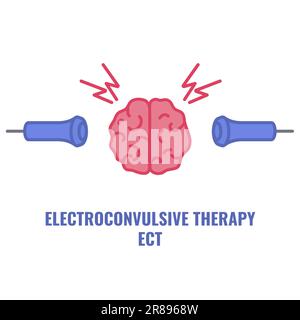 ECT electroconvulsive therapy for severe depression treatment Stock ...