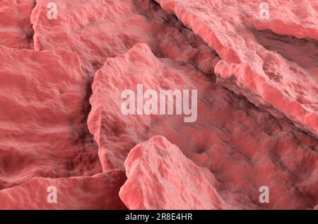 Illustration of psoriasis Stock Photo - Alamy