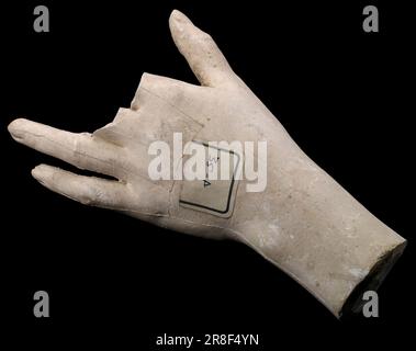 Cast of an Unidentified Womans Left Hand and Forearm Stock Photo - Alamy