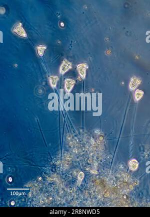 Feeding ciliates from the genus Vorticella (or Pseudovorticella ...