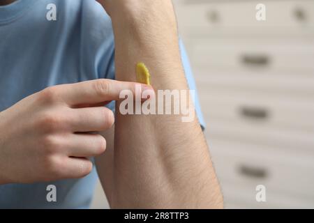 Man applying yellow ointment onto his arm on light blue background ...