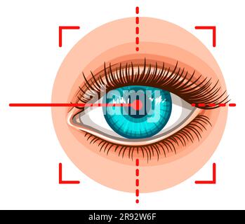 Vision correction by a laser beam. Eye surgery. Ophthalmologist vector ...