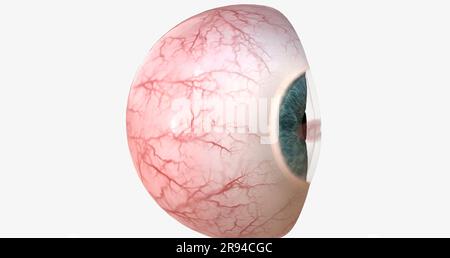 A corneal abrasion, or scratch, is a shallow injury to the surface of ...