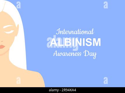 Beautiful albino woman on a soft blue background. International ...