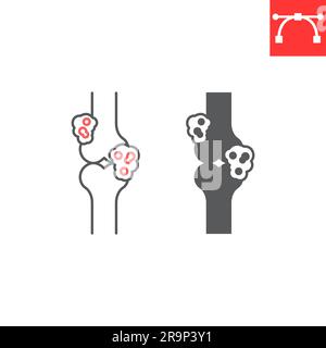 Osteosarcoma. Malignant bone tumor. Human leg with Bone cancer. Close ...