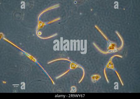 Marine dinoflagellates from genus Tripos (syn: Ceratium), probably T ...
