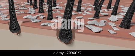 Hair follicles and dandruff under microscope - 3D illustration Stock ...