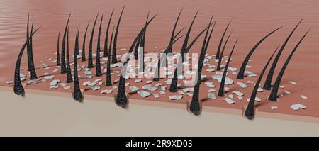 Hair follicles and dandruff under microscope - 3D illustration Stock ...