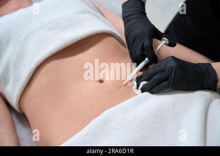 Injections for lifting the skin of the abdomen Stock Photo - Alamy