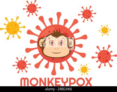 Monkey Pox Outbreak Vector Illustration of Virus Symptoms in Humans ...