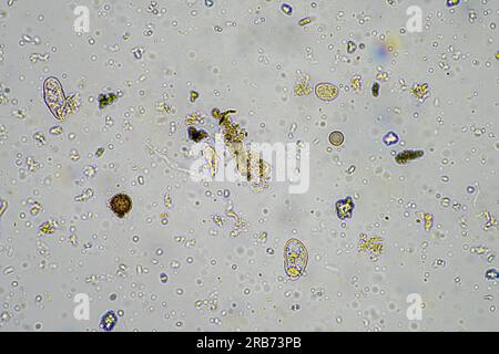 soil sample containing soil biology, with bacteria, fungi, amoeba ...