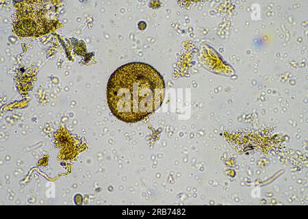 soil sample containing soil biology, with bacteria, fungi, amoeba ...