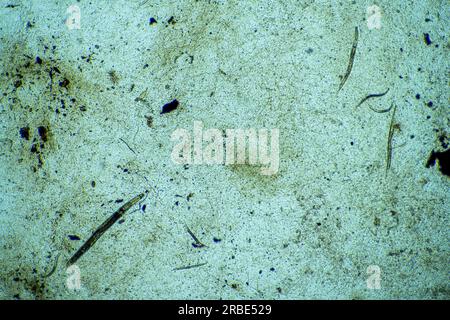 nematode under the microscope in a lab Stock Photo - Alamy