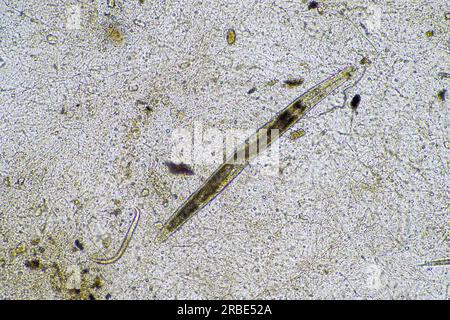 nematode under the microscope in a lab Stock Photo - Alamy