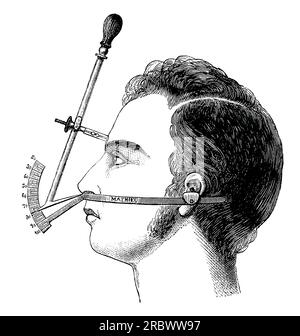 Median facial goniometer of Pierre Paul Broca, 1824 – 1880, French ...
