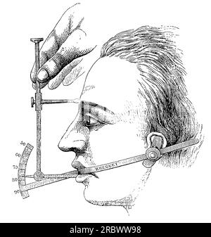 Median facial goniometer of Pierre Paul Broca, 1824 – 1880, French ...