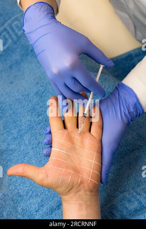 Beautician makes intramuscular injections of botulinum toxin in armpit ...
