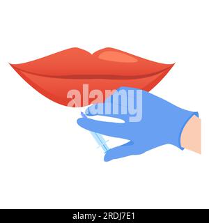 Lip augmentation, illustration Stock Photo - Alamy