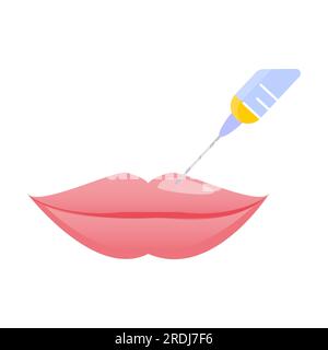 Lip augmentation, illustration Stock Photo - Alamy