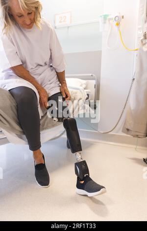 Senior caucasian female patient with prosthetic leg sitting on bed at ...