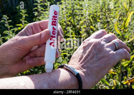 Woman applying After Bite from an applicator to soothe a nettle sting ...