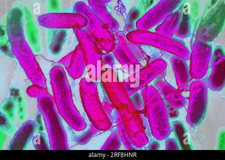 Escherichia coli (intestinal bacteria that resides in the digestive ...