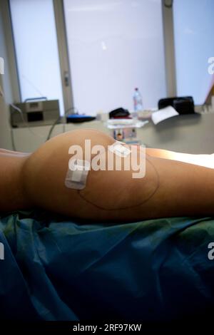 Cosmetic surgery, liposuction, aspiration of fat by a pump Stock Photo ...
