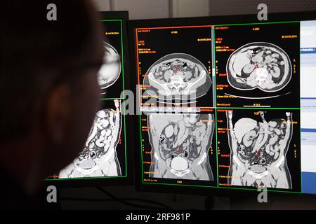 Doctor analyzing a CT scan of the abdomen in a hospital radiology ...