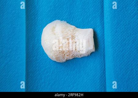 Viro-inactivated bone graft prepared in a tissue and cell biobank Stock ...