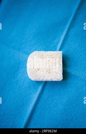 Viro-inactivated bone graft prepared in a tissue and cell biobank Stock ...