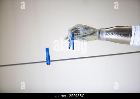 Person equipped with a robotic arm prosthesis Stock Photo - Alamy