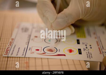 Biological compatibility test before a postoperative blood transfusion ...