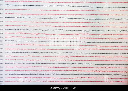 Magnetoencephalography (MEG) is a neuroimaging that records the ...